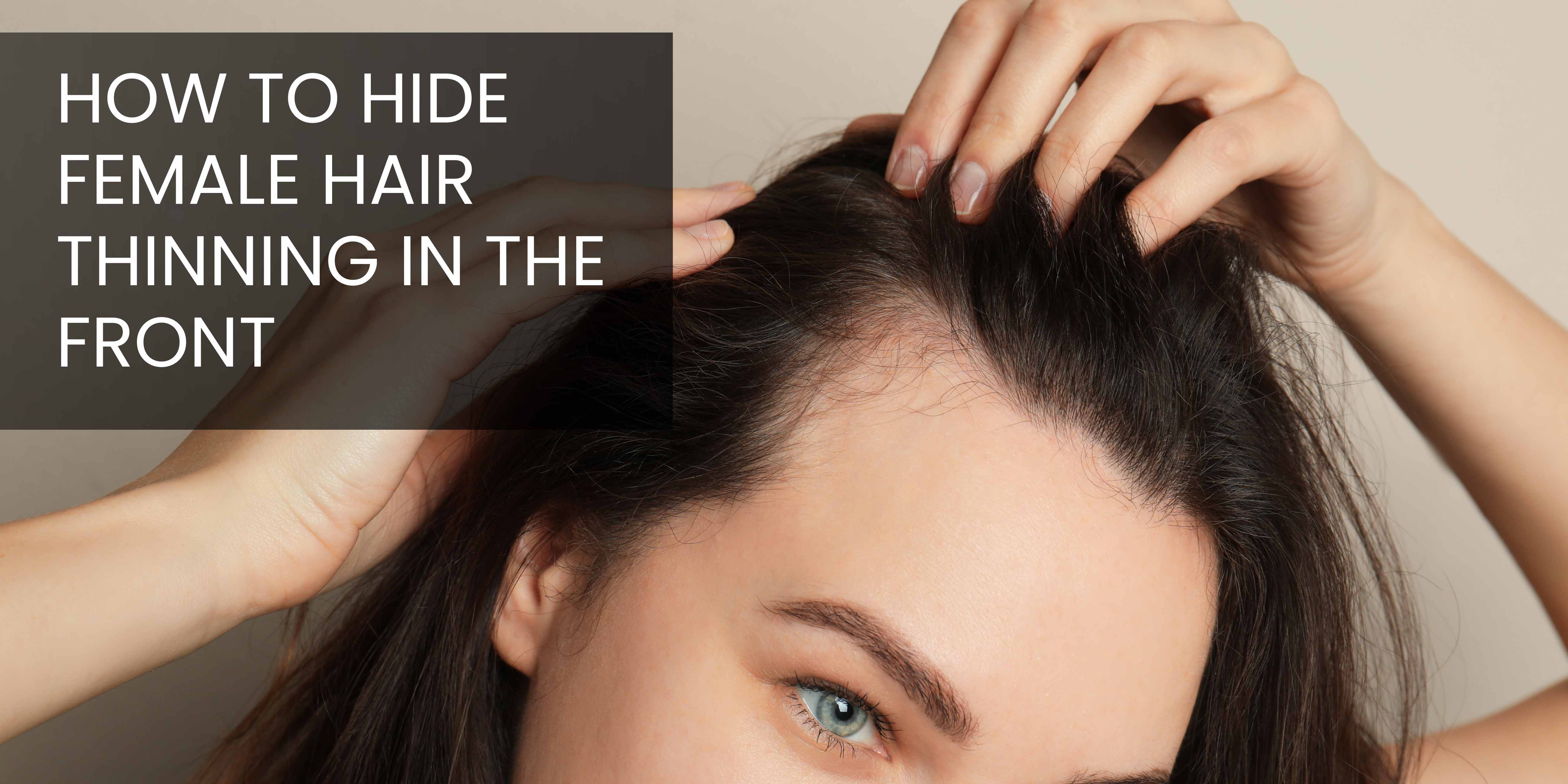 How to Hide Female Hair Thinning in the Front SURETHIK USA